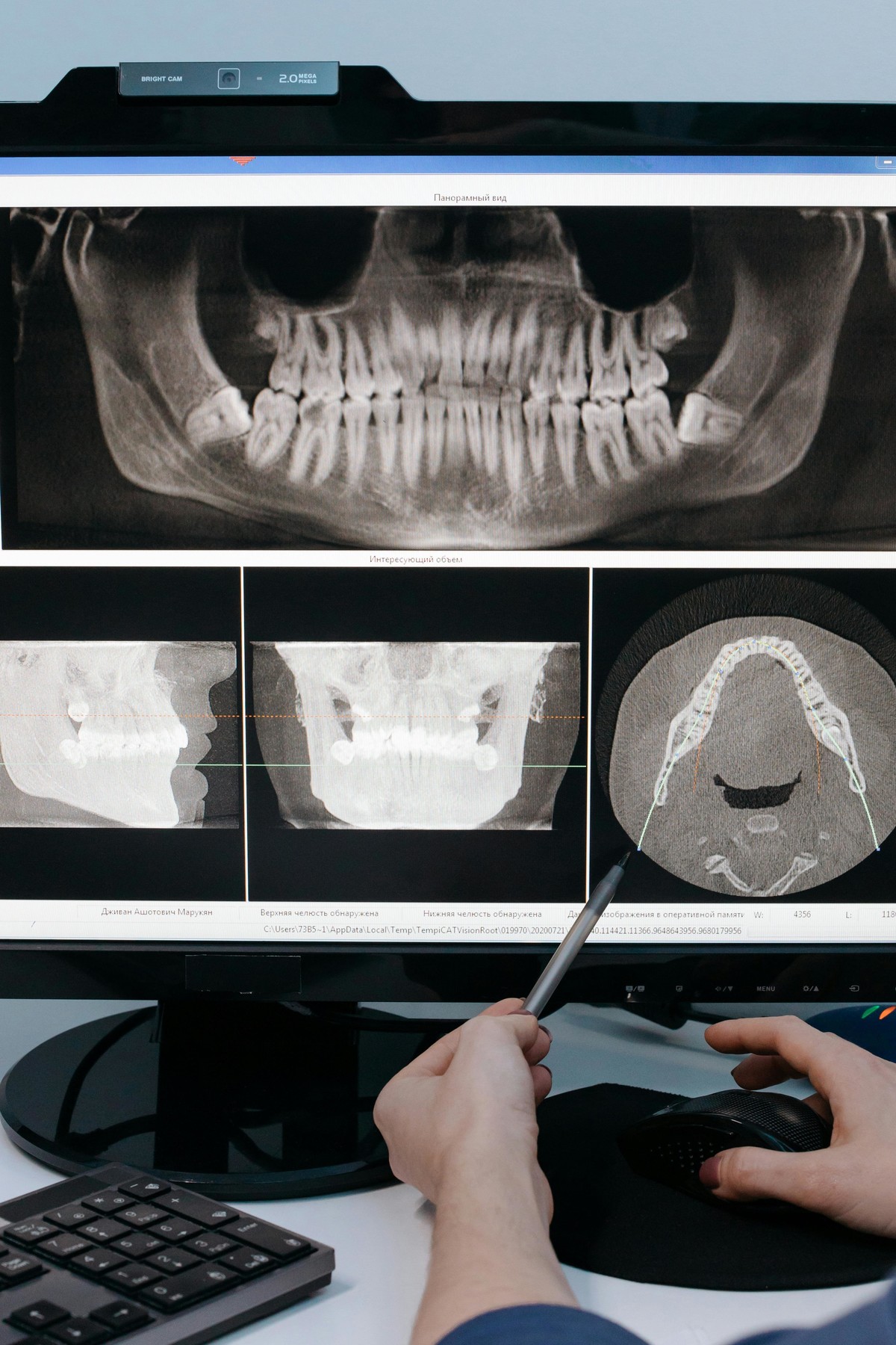 TMJ Dysfunction & the Cranial System: An Osteopathic Perspective ...